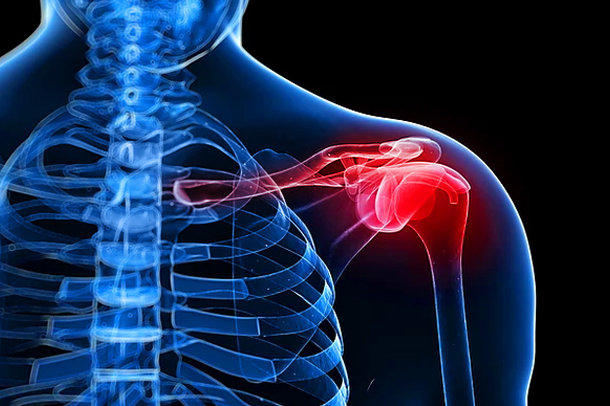 shoulders – Chiropractic Care in Houston