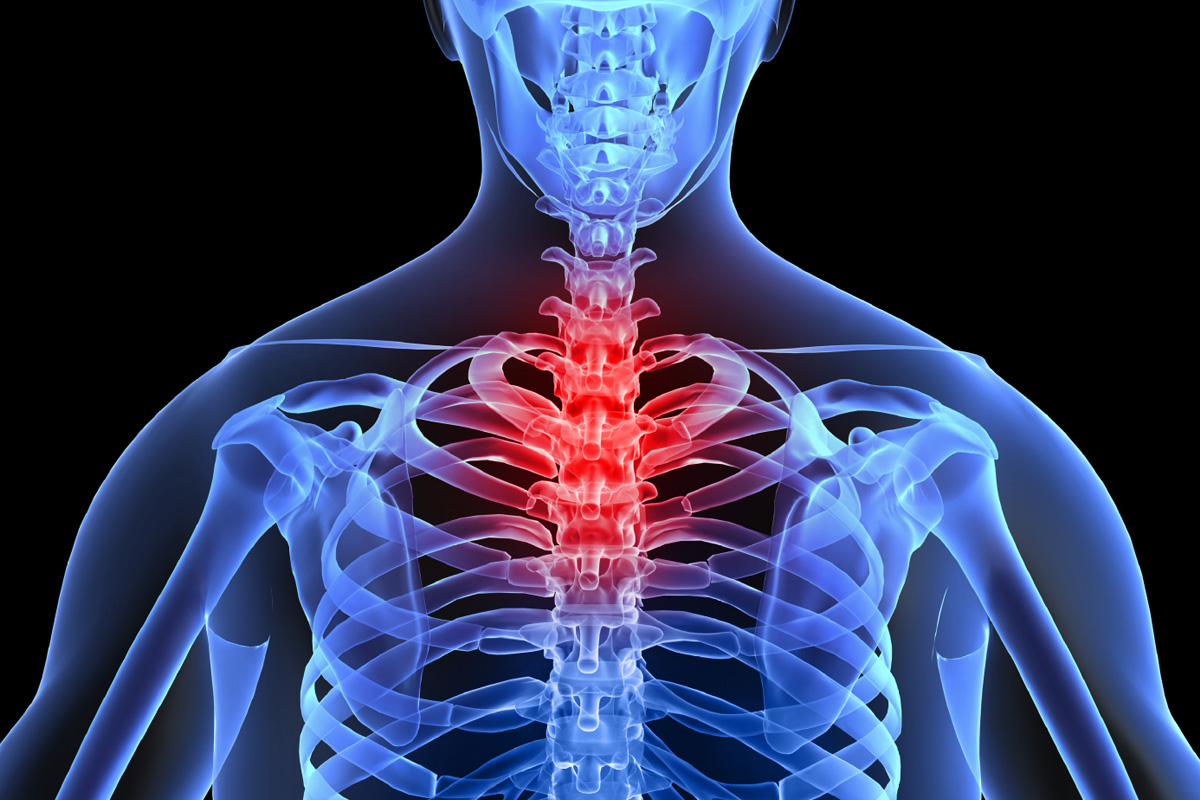 upper back – Chiropractic Care in Houston