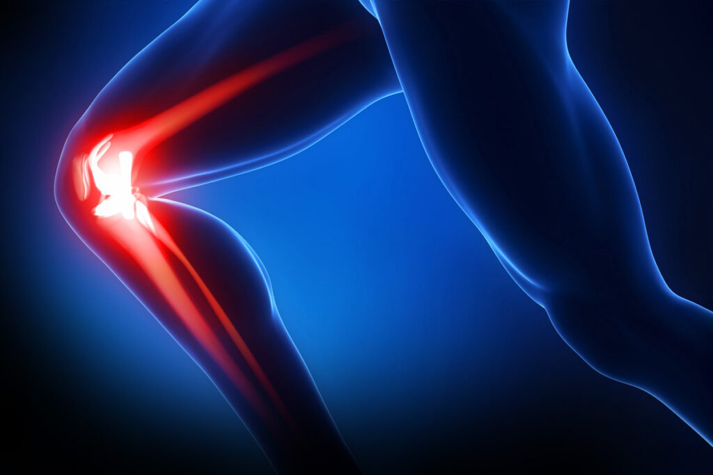 knees – Chiropractic Care in Houston